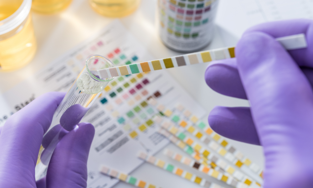 What are drug tests detecting in New Zealand workplaces? | Human ...